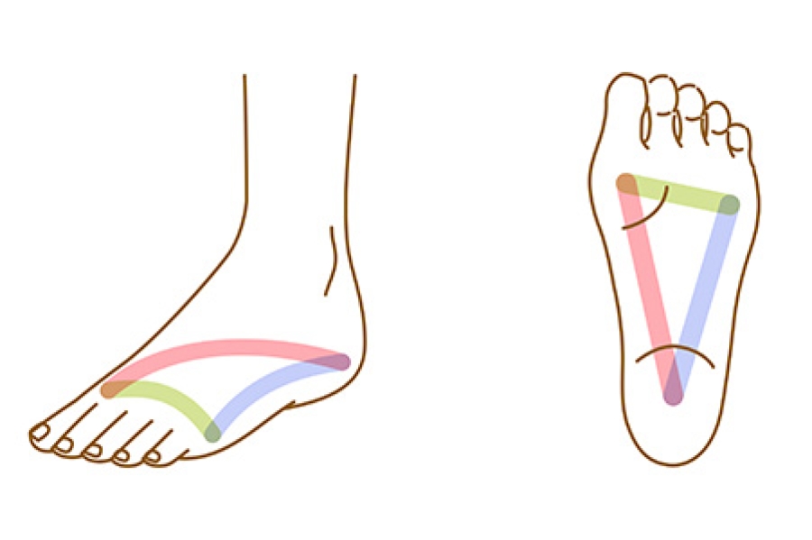 Foot Arch Types and How to Support Them
